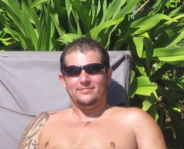 Photos | FTM Top Surgery Dr Charles Garramone The Best Plastic Surgeon